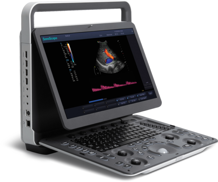 Ultrasound Sales - Sono Solutions