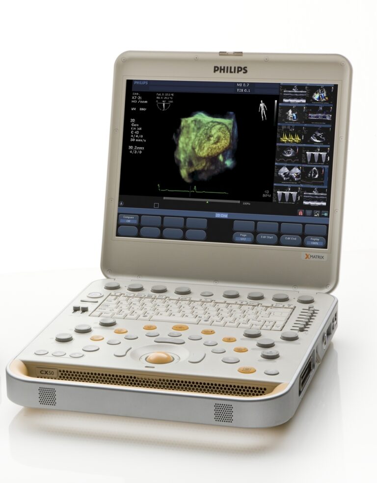 Philips CX50 POCUS Ultrasound System - Sono Solutions