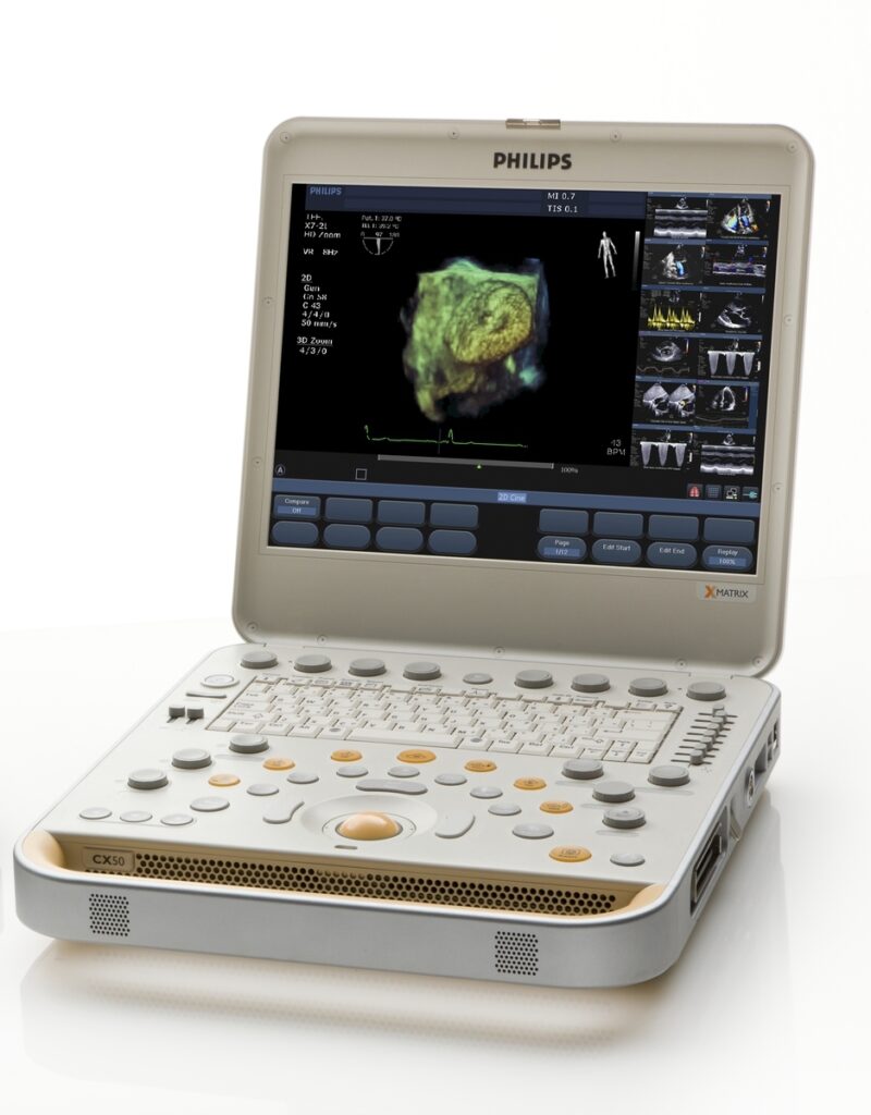 Compact Ultrasound Systems - Sono Solutions