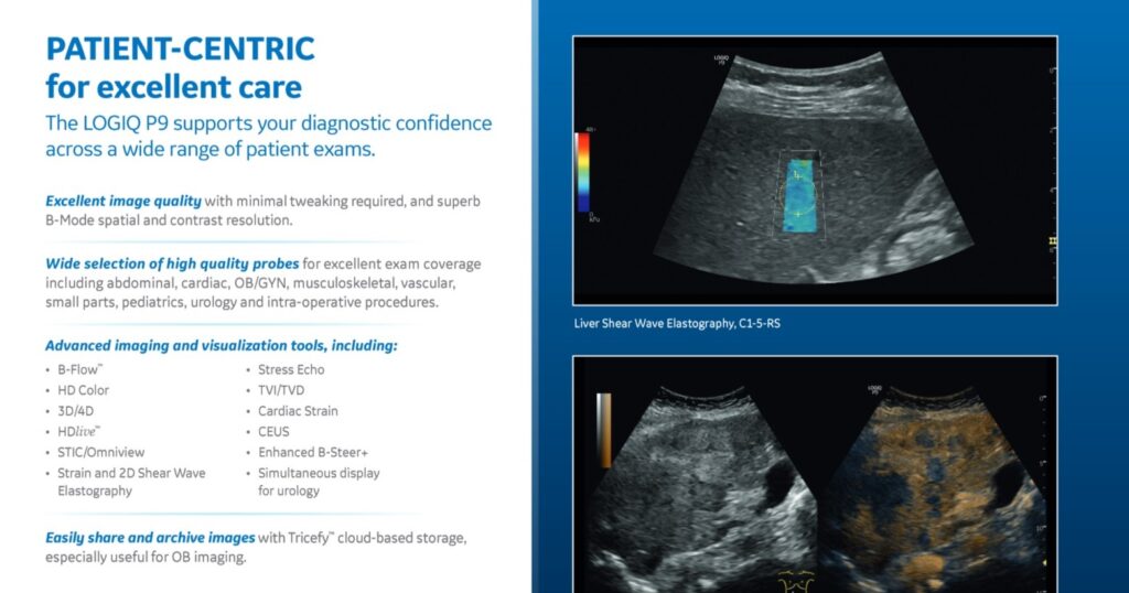 GE Logiq P9 Budget Console Ultrasound System - Sono Solutions