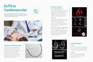 SonoScape P60 Premium Class Ultrasound System - Sono Solutions