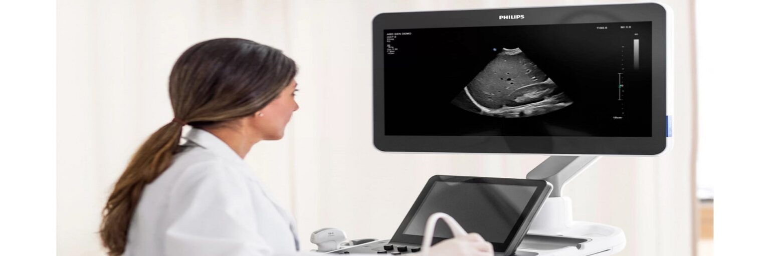 Philips Epiq Premium Console Ultrasound Systems - Sono Solutions