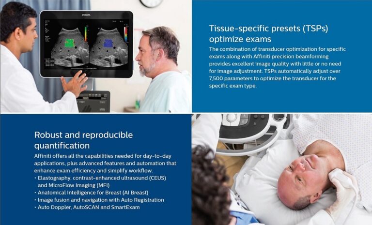 Philips Intermediate Console Ultrasound Systems - Sono Solutions