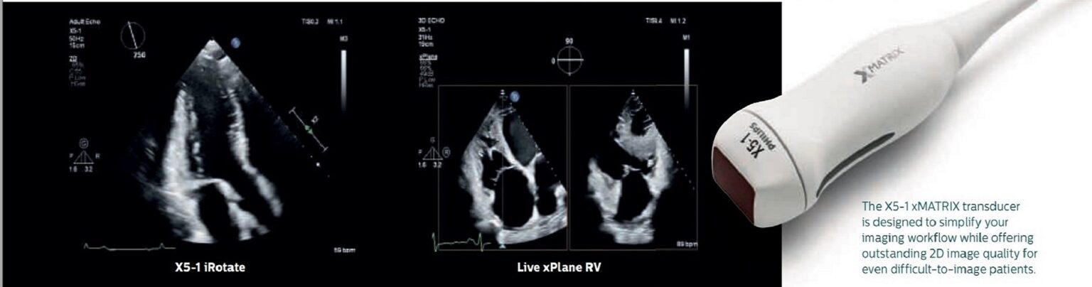 Philips Intermediate Console Ultrasound Systems - Sono Solutions
