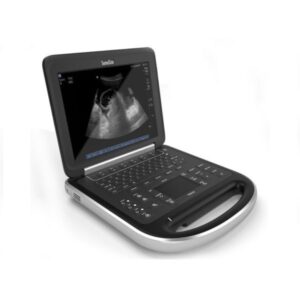 SonoSite Edge II portable Ultrasound System - Sono Solutions