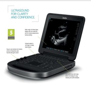 SonoSite Edge II portable Ultrasound System - Sono Solutions