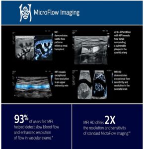 Philips Epiq Premium Console Ultrasound Systems - Sono Solutions