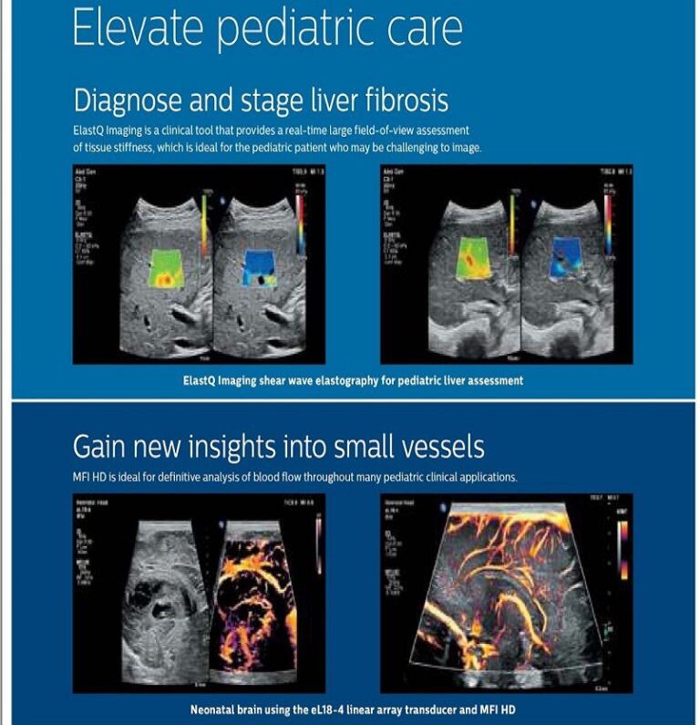 Philips Epiq Premium Console Ultrasound Systems - Sono Solutions
