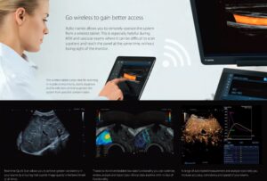 Canon i900 Series Premium Console Ultrasound Systems - Sono Solutions