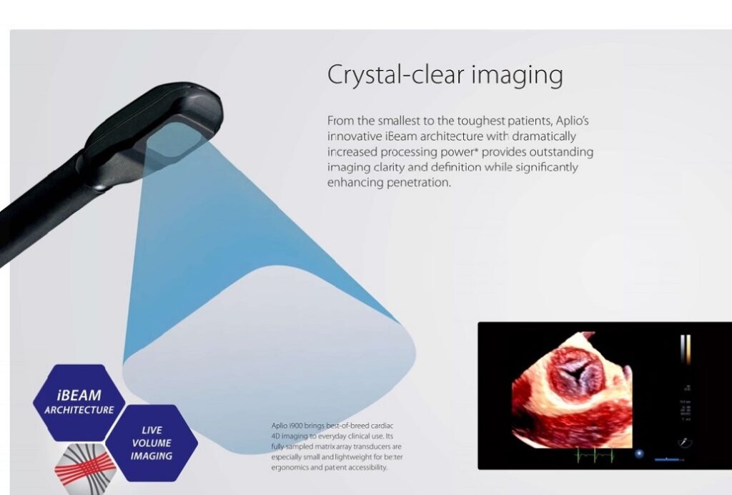 Canon i900 Series Premium Console Ultrasound Systems - Sono Solutions