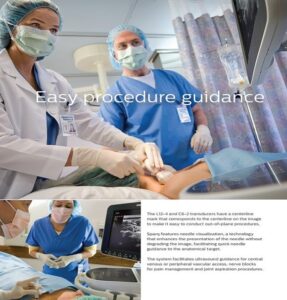 Philips POCUS Ultrasound Systems - Sono Solutions